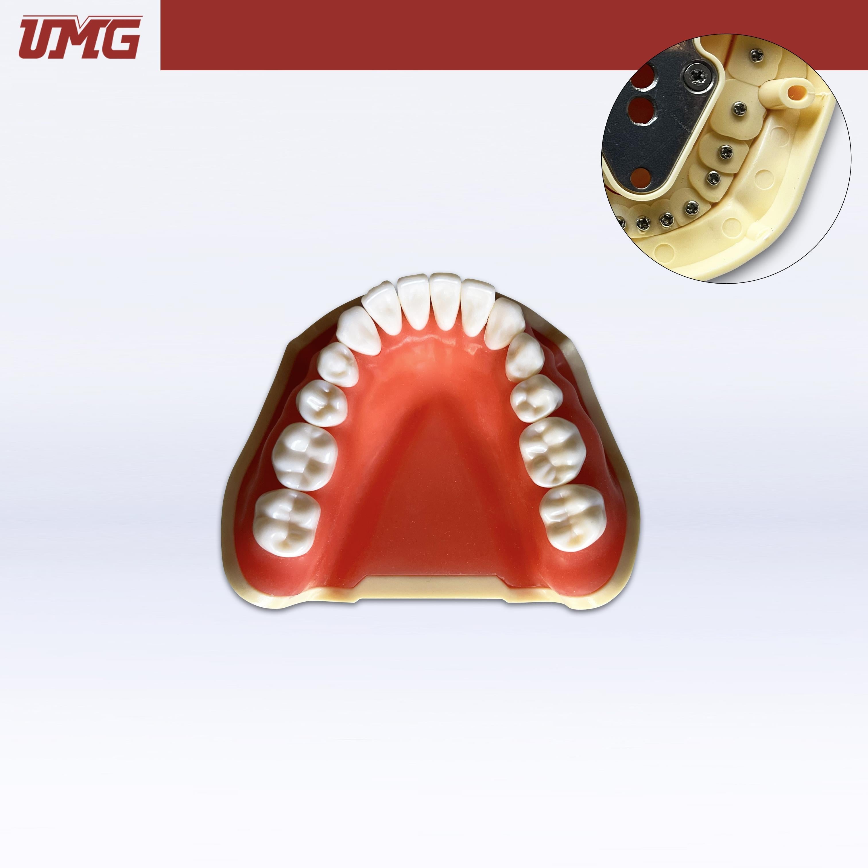 Umg Dental - Umg Model Removable Teeth Training Model Lower - Frasaco ...