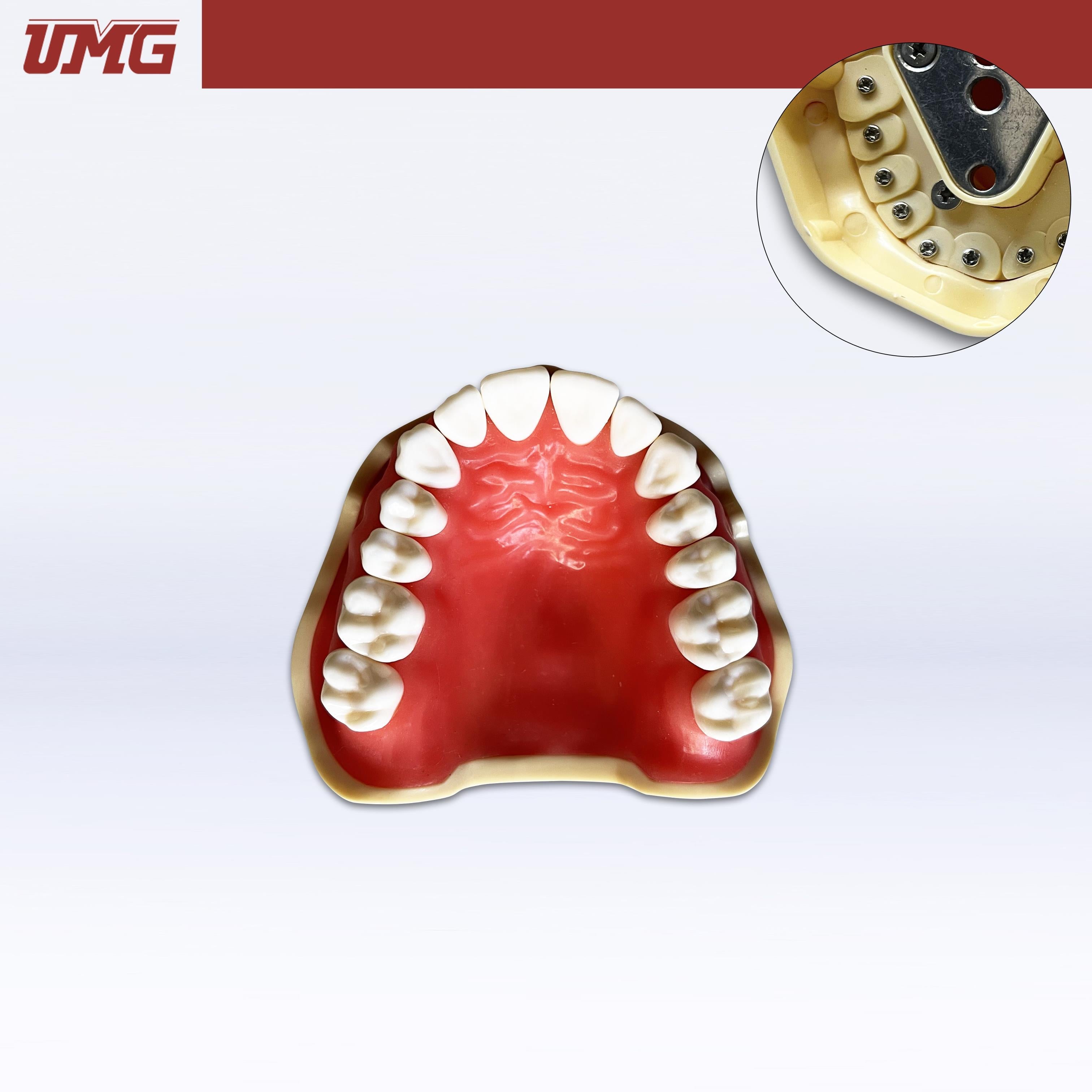 Umg Dental - Umg Model Removable Teeth Training Model Upper - Frasaco ...